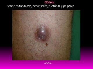 Semiología de Piel | PPT