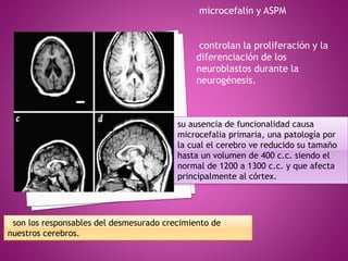 microcefalia resumen | PPTX