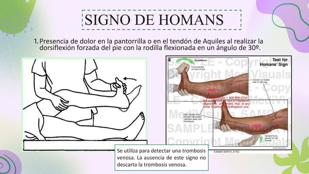 EXPO -EXPLORACION VENOSA.pptx (1).pdf