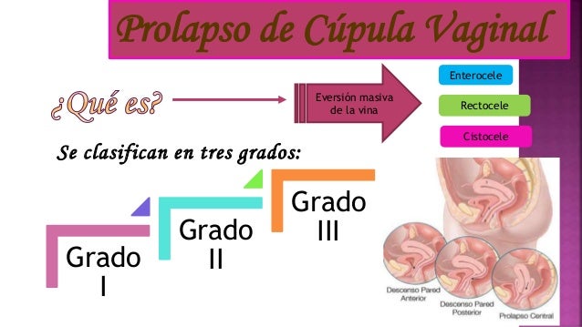 PERFIL VAGINAL