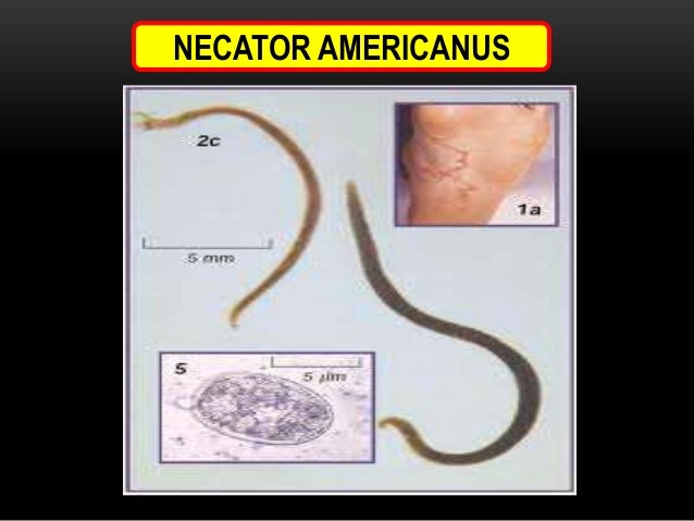 Necator Americanus
