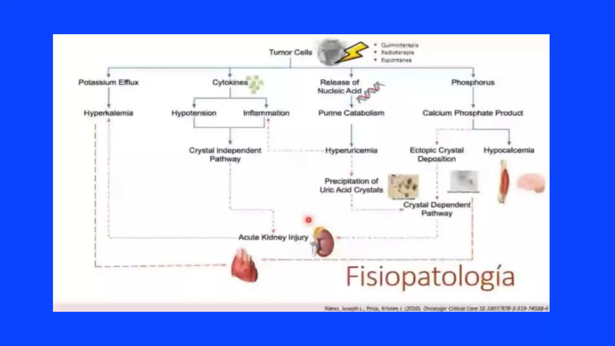 Sindrome de lisis tumoral.pptx