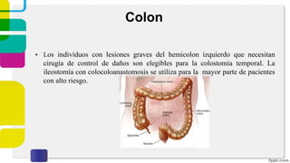 Trauma Abdominal | PPTX