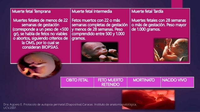 Autopsia fetal, instrumentos, toma de muestras, fotografia