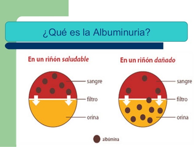 albuminuria