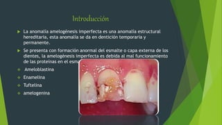 Amelogenesis Imperfecta Anomalía Dental Pptx