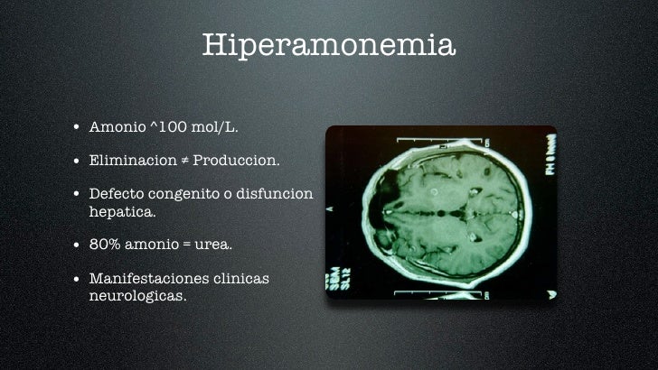 HIPERAMONEMIA TIPO 1 PDF
