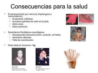 Biorremediación de mercurio por células de la bacteria acumuladora de ...