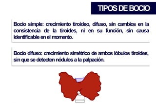 EXPO BOCIO 2.0.pptx