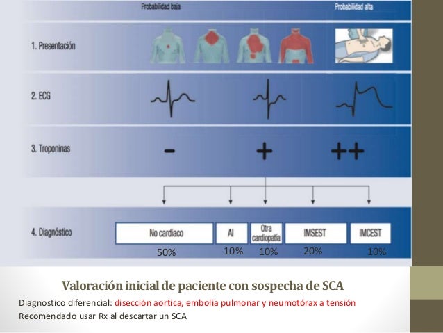 Expo cardio sca con y sin elevacion st