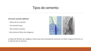 CEMENTO RADICULAR | PPTX