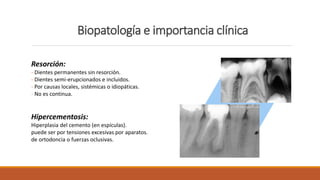 CEMENTO RADICULAR | PPTX