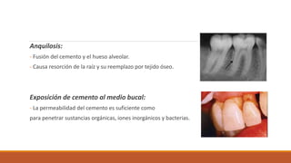 CEMENTO RADICULAR | PPTX