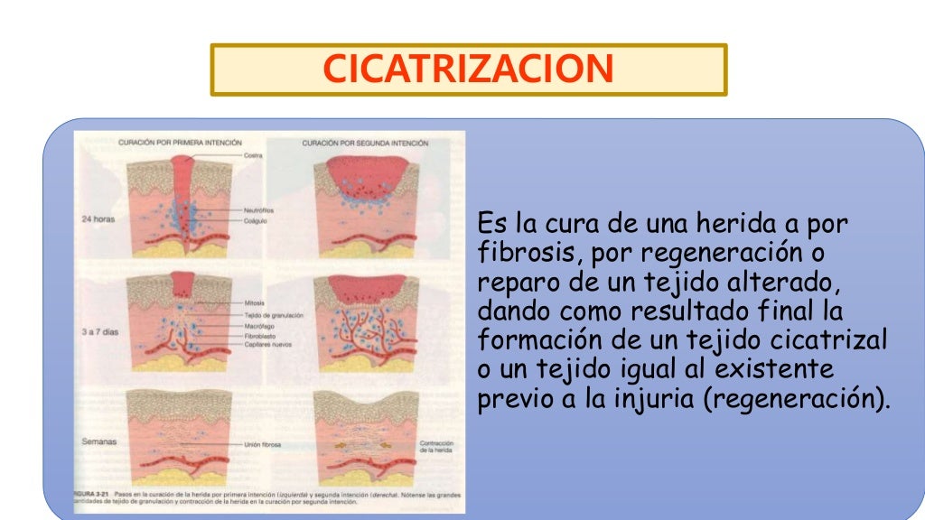 CICATRIZACION DE LAS HERIDAS