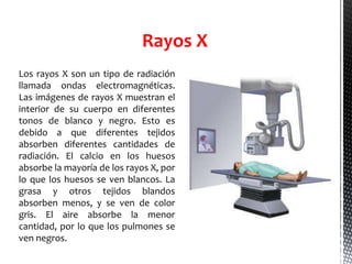 TAC, RESONANCIA MAGNÉTICA NUCLEAR, ELECTROENCEFALOGRAMA, RAYOS X Y ...