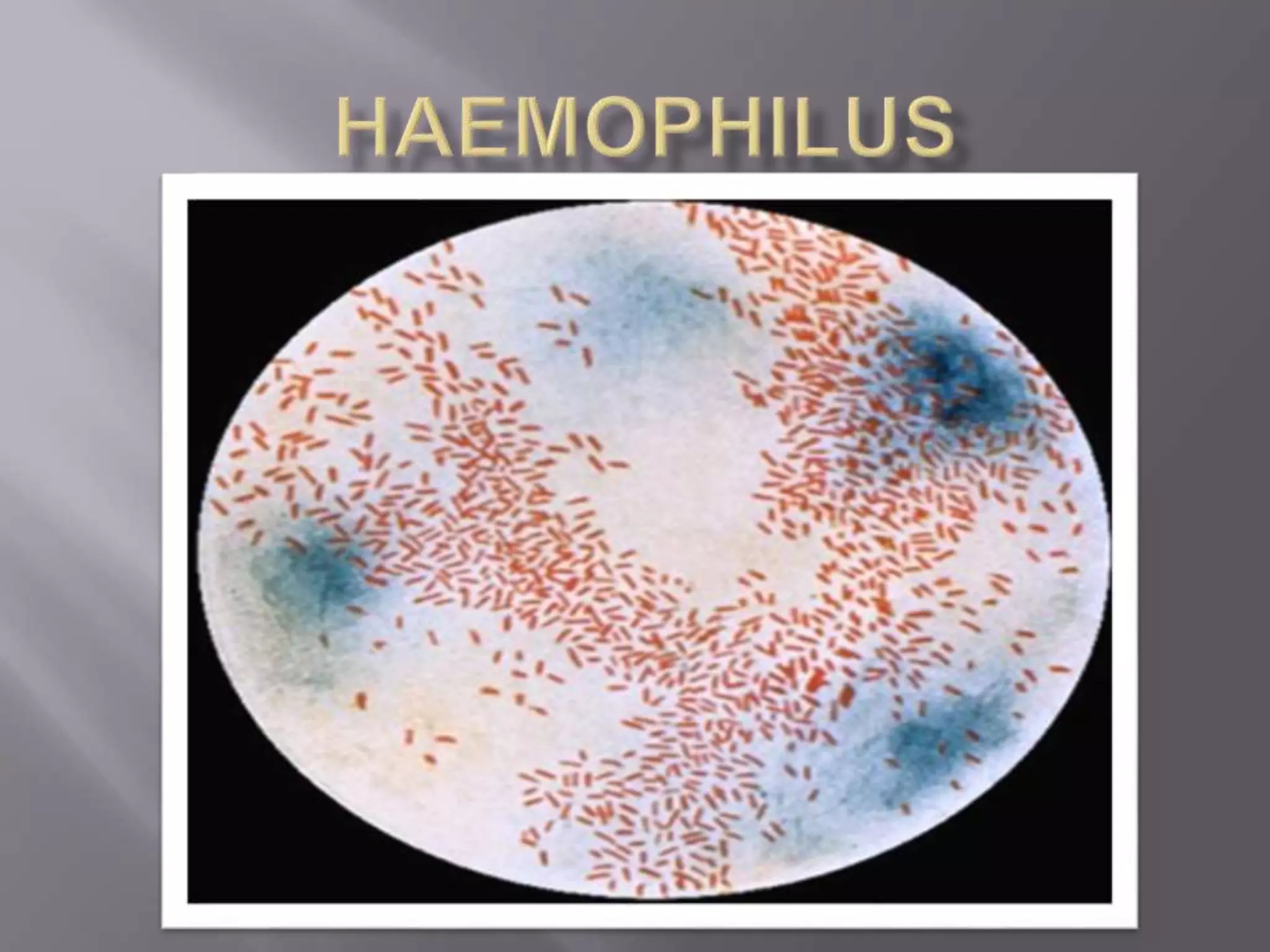 HAEMOPHILUS PARAGALLINARUM MVZ | PPTX
