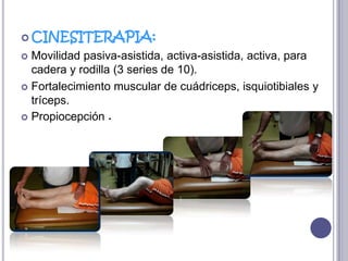 Prótesis De Cadera Y Rodilla En Paciente Con Parkinson Pptx