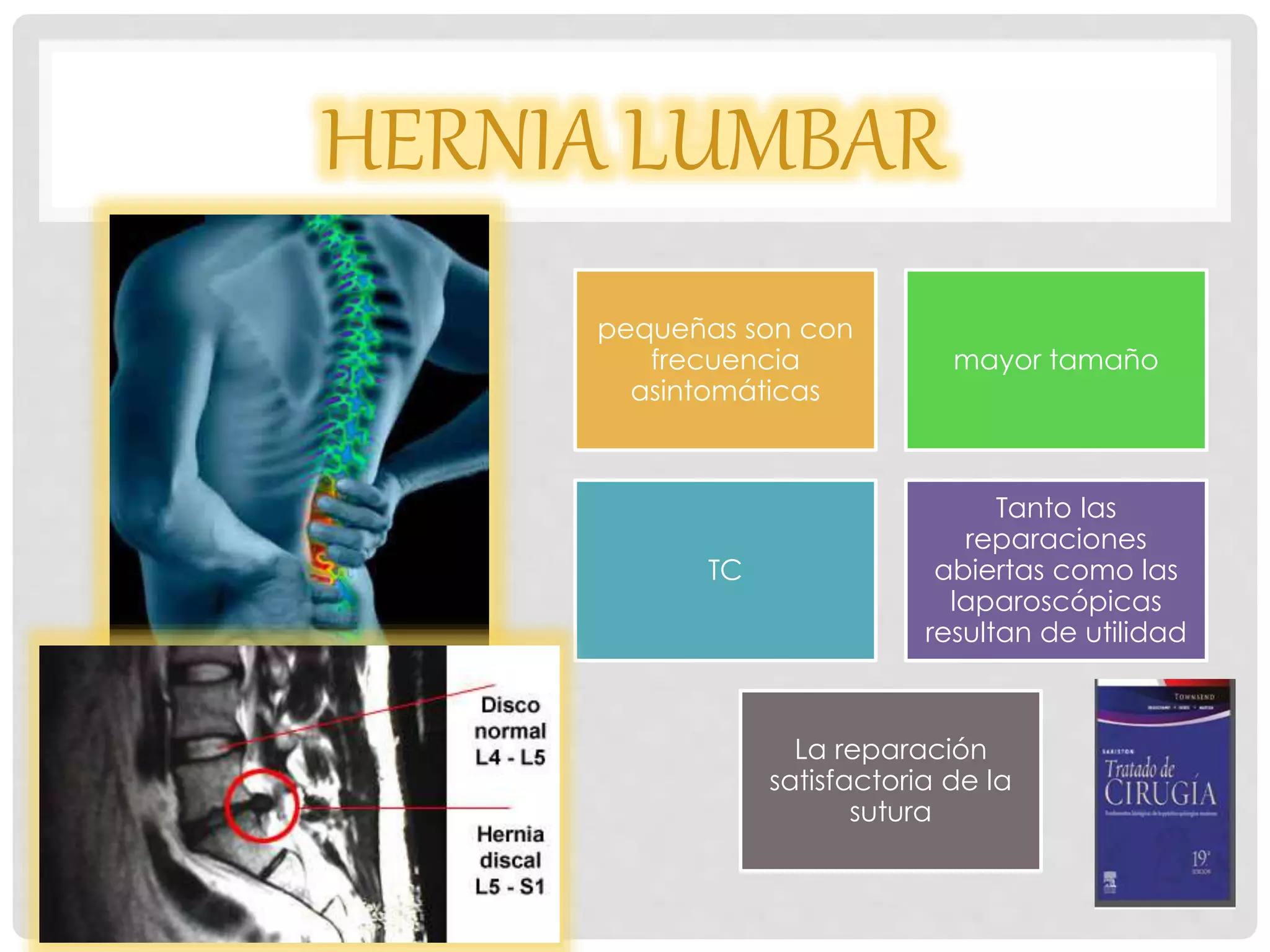HERNIAS PARED ABDOMINAL ANTEROLATERAL Y LUMBAR | PPTX | Digestive ...