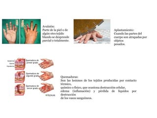 tipos de heridas y clasificicacion | PPTX