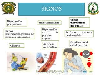 tipos de choques e insuficiencia pulmonar aguda en pacientes qx | PPTX