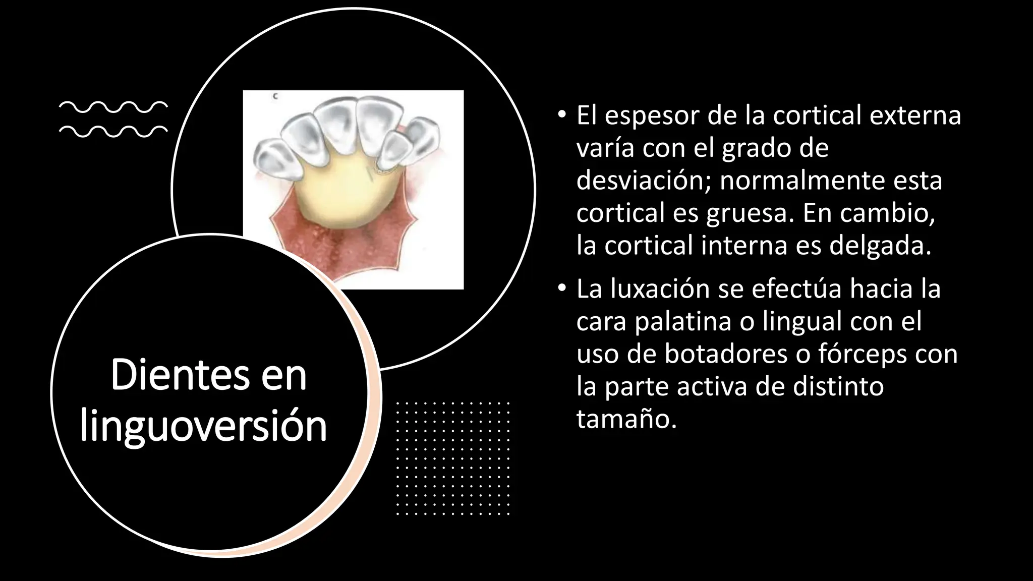 exodoncia de erupcion de dientes ectopicos | PPT