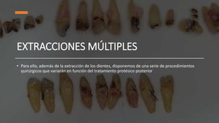 exodoncia de erupcion de dientes ectopicos | PPTX