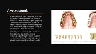 exodoncia de erupcion de dientes ectopicos | PPTX