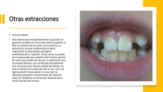 exodoncia de erupcion de dientes ectopicos | PPTX