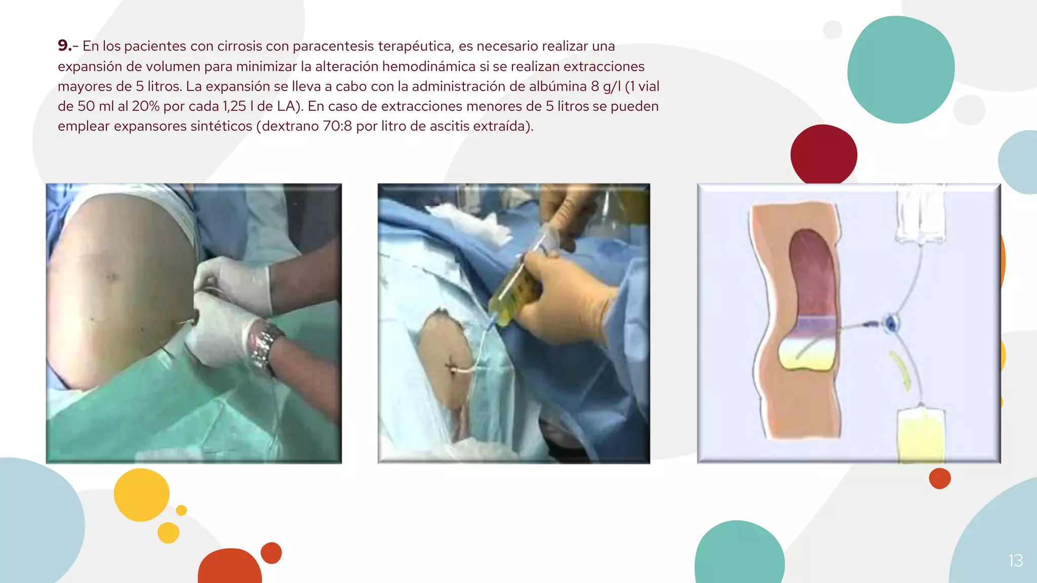 Análisis de Líquido Peritoneal | PDF