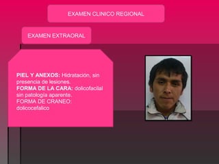 caso clinico tratamiento remanente radicular | PPT