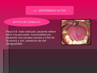 caso clinico tratamiento remanente radicular | PPT