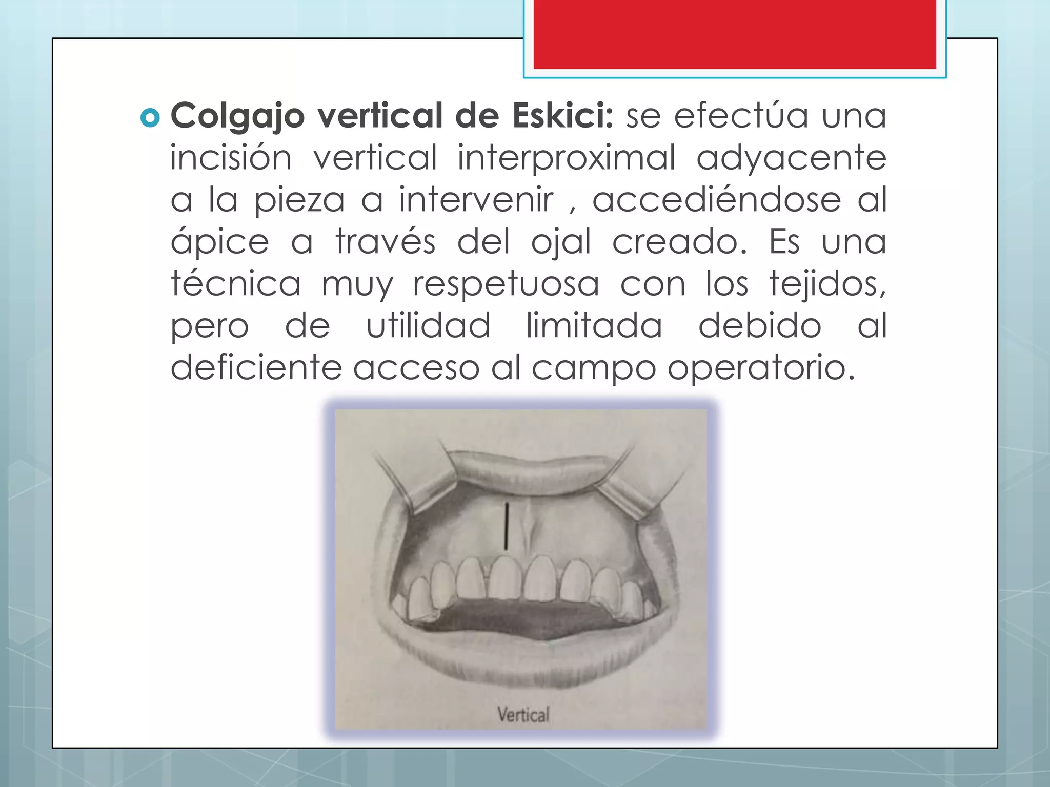 Expo de cirugia suturas y colgajos | PPTX
