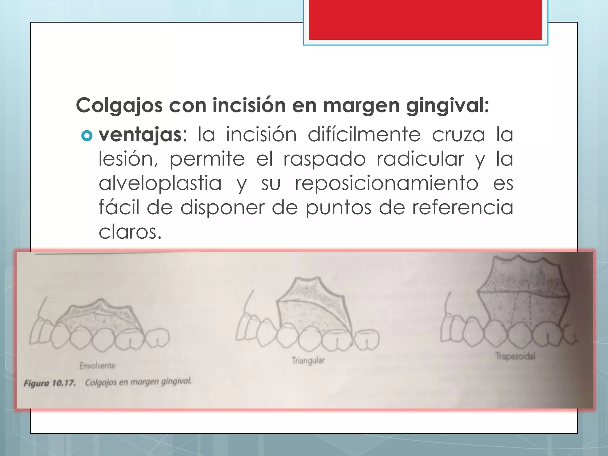Expo de cirugia suturas y colgajos | PPTX