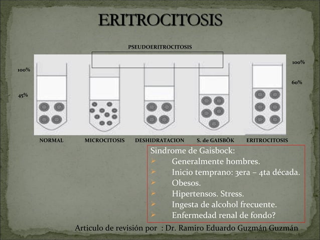 Eritrocitosis | PPT