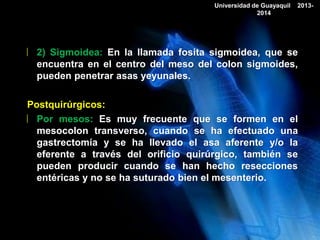 Tratamientos de las Hernias lumbares, Hernias glúteas, Hernias del ...