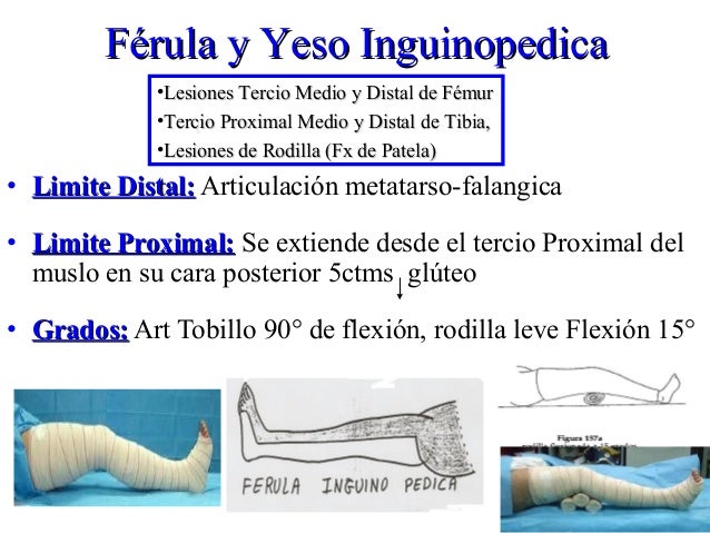 Inmovilizaciones Traumatologia