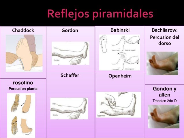 examen fisico neurologico