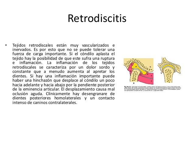 Transtornos Temporomandibulares