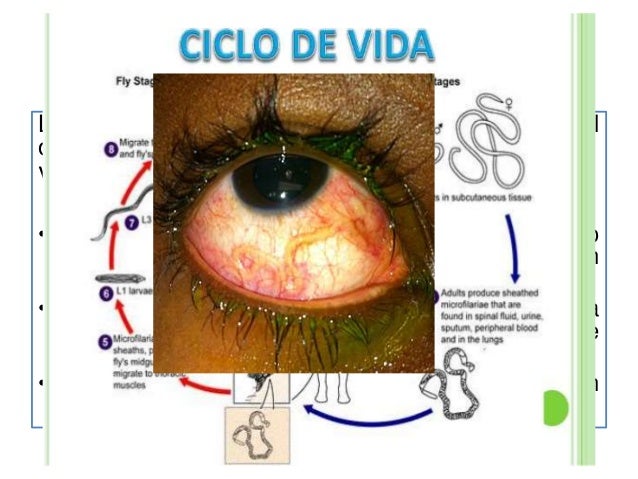 Infecciones cutaneas por helmintos