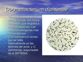 difteria | PPT