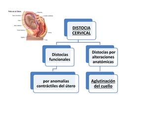 Expo distocias de partes blandas | PPTX