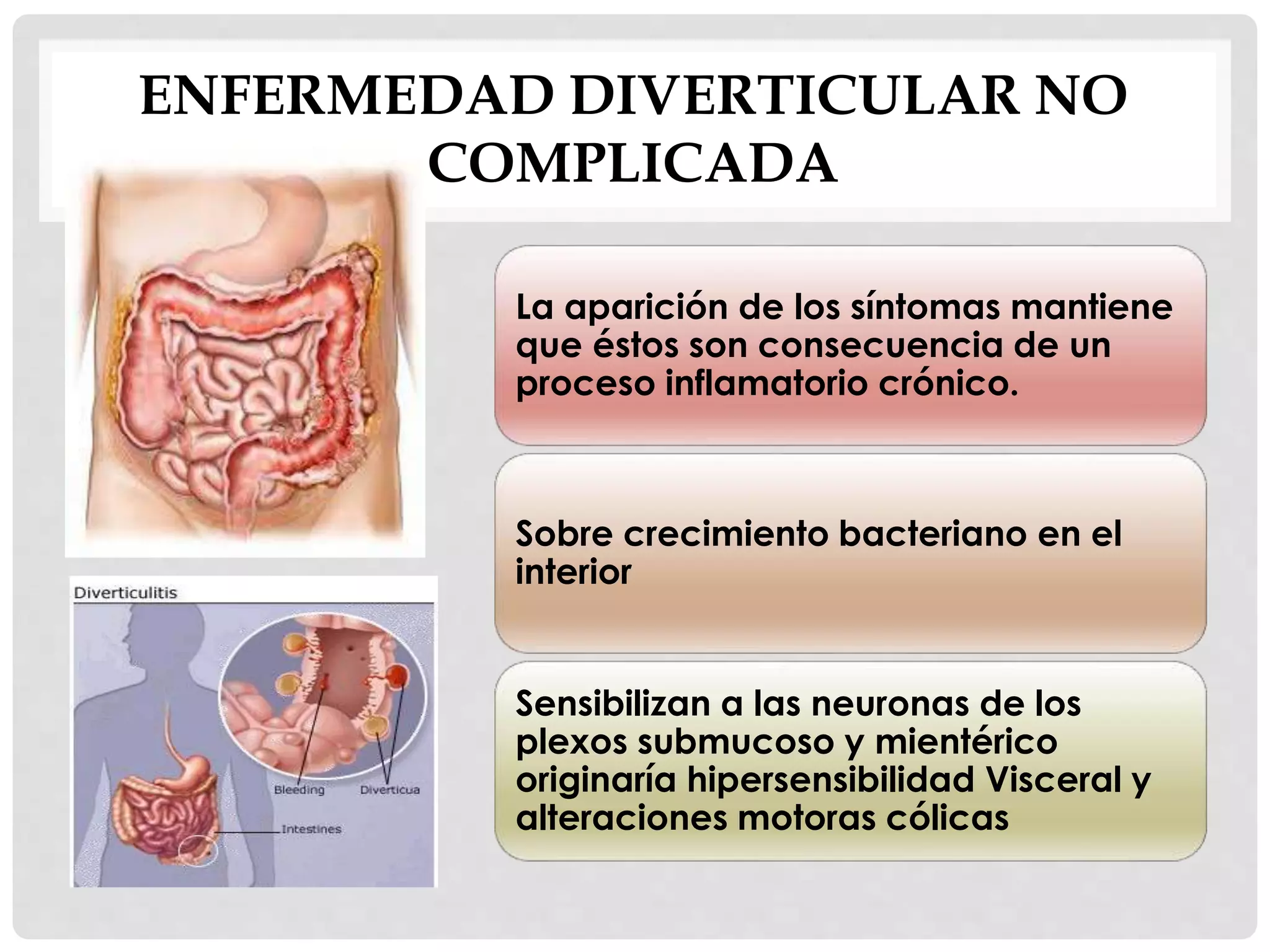 DIVERTICULITIS INTESTINAL | PPT