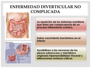 DIVERTICULITIS INTESTINAL | PPTX