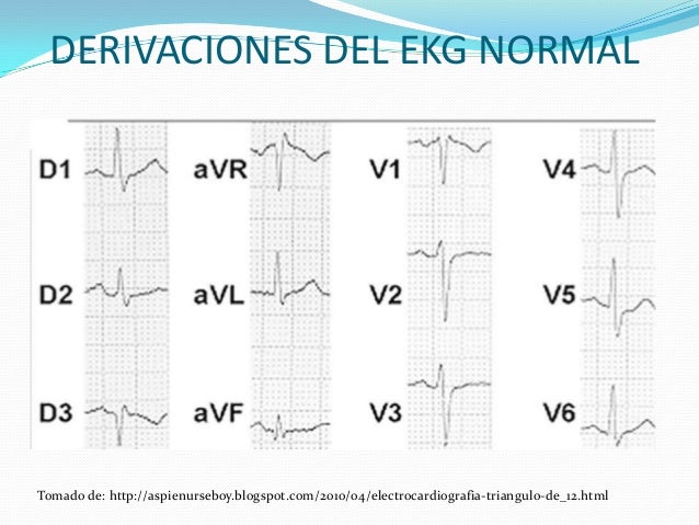 ELECTROCARDIOGRAMA NORMAL