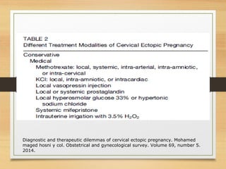 Expo embarazo ectopico cervical 2015 | PPT