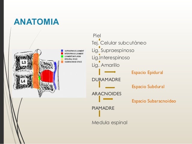 Anestesia epidural