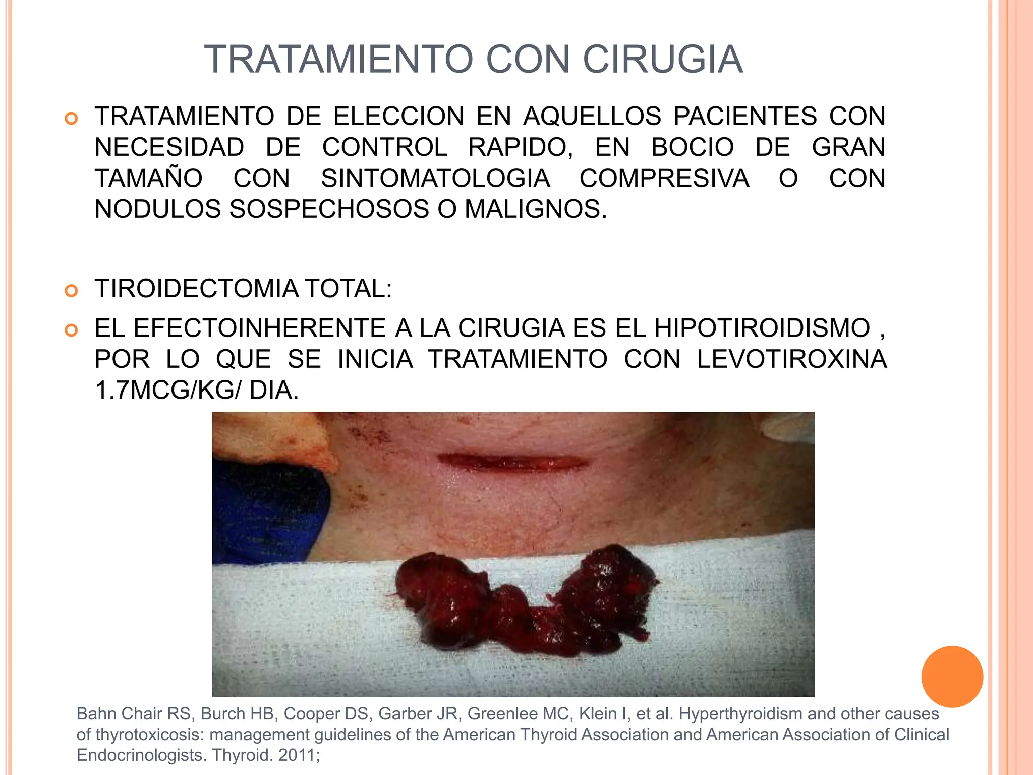 EXPO HIPERTIROIDISMO, definicion, dignostico y tratamiento | PPTX