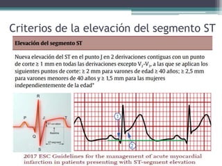 EXPO IMASTE ,infarto agudo de miocardio st elevado.pptx