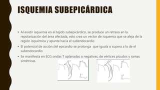 expo lesion e isquema subepi y subendo.pptx