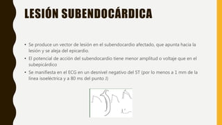 expo lesion e isquema subepi y subendo.pptx
